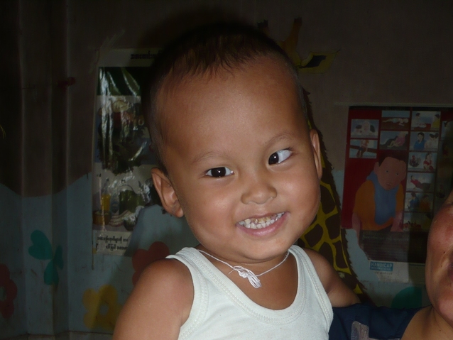 Success! Myo Win from Burma raised $1,485 for life-saving brain surgery ...