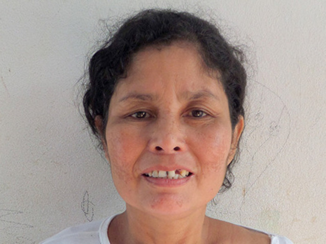 Thidar from Burma raised $540 to get healthy. | Watsi