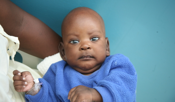 Success! Felix from Kenya raised $805 for surgery to treat spina bifida ...