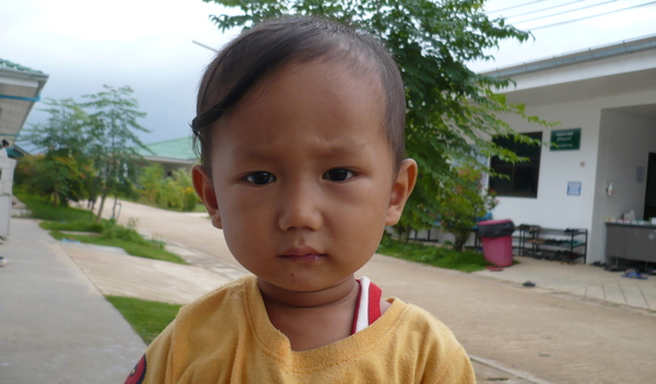 Dah Htoo from Burma raised $1,500 to treat burns on his hand. | Watsi
