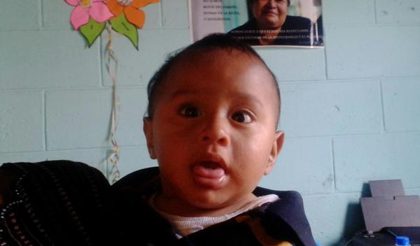 Success! Yonathan from Guatemala raised $512 for life-saving ...
