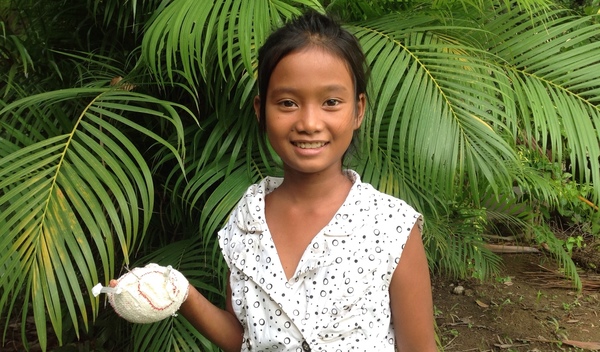 Success! Srey Leak from Cambodia raised $194 so she can use her hand ...