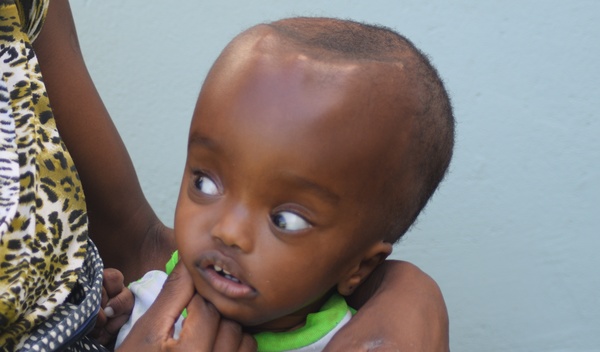 Success! Hamida from Tanzania raised $775 to fund life-changing brain ...