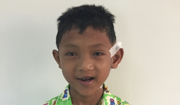 Success! Kosal from Cambodia raised $842 to fund ear surgery. | Watsi