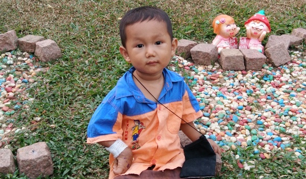 Dah Htoo from Burma raised $1,500 to fund burn repair. | Watsi
