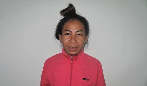 Success! Sophea from Cambodia raised $264 to fund surgery to correct a ...