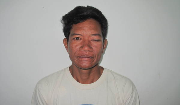 Success! Sam Ang from Cambodia raised $292 to fund eye surgery. | Watsi