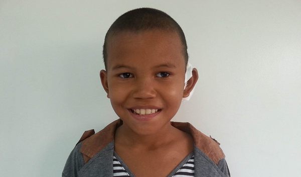 Success! Reaksa from Cambodia raised $423 to fund ear surgery. | Watsi