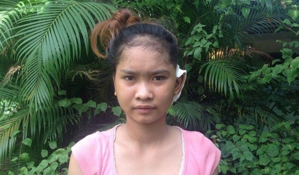 Success! Srey Mean from Cambodia raised $423 to fund ear surgery. | Watsi