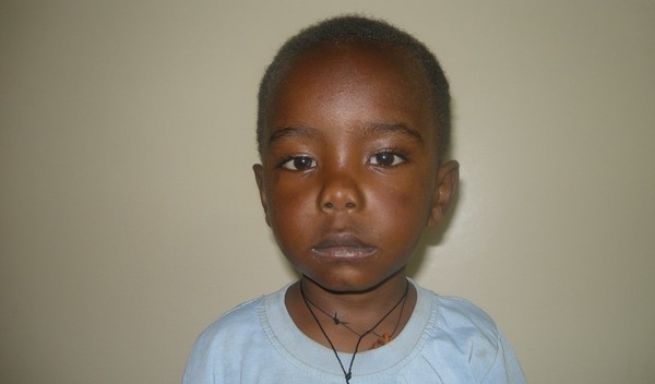 Success! Yabsira from Ethiopia raised $1,231 to fund corrective surgery ...
