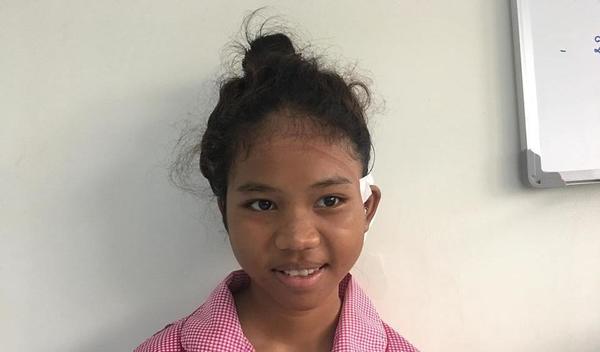 Success! Srey Neth from Cambodia raised $423 to fund ear surgery. | Watsi