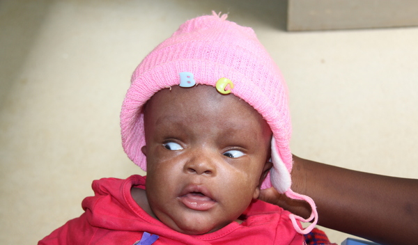 Success! Reuben from Kenya raised $685 to fund brain surgery. | Watsi