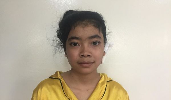 Success! Pheak from Cambodia raised $423 to fund ear surgery. | Watsi