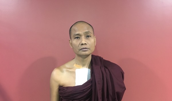 Success! Agga from Burma raised $1,500 to fund heart surgery. | Watsi