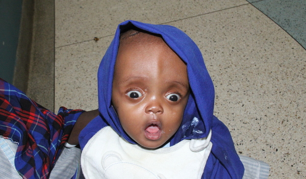 Success! Monicah from Kenya raised $685 to fund brain surgery. | Watsi