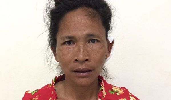 Success! Kruy from Cambodia raised $464 to fund myringoplasty ear ...