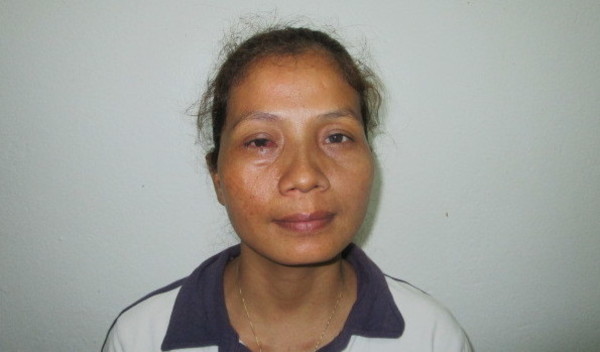 Success! Phally from Cambodia raised $216 to fund pterygium eye surgery ...