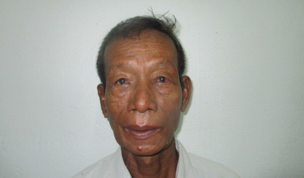 Success! Chhoeun from Cambodia raised $229 to fund cataract surgery ...