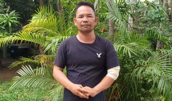 Success! Phearum from Cambodia raised $230 to fund arm fracture hardware removal. | Watsi