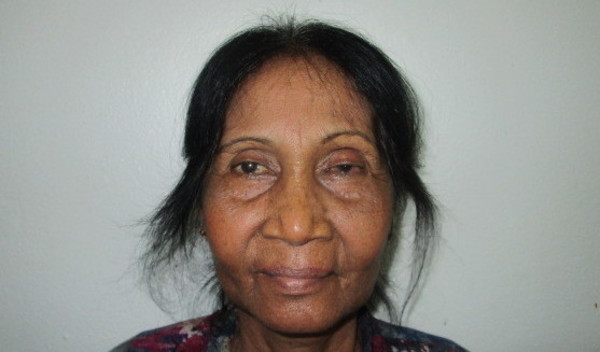 Success! Sopheap from Cambodia raised $229 to fund cataract surgery ...