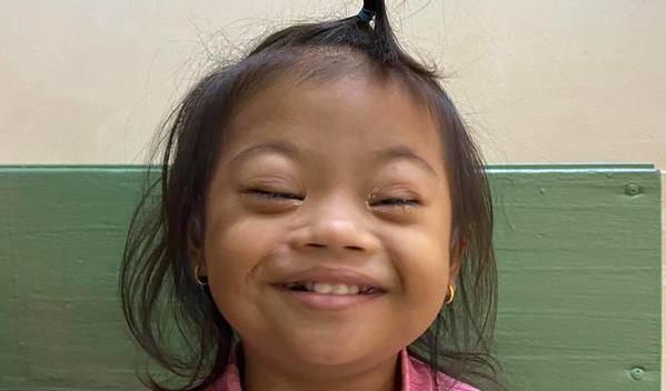 Success! Chanthou from Cambodia raised $425 to fund cataract surgery ...