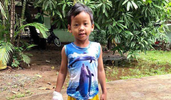 Success! Sophea from Cambodia raised $477 to fund burn surgery on his ...
