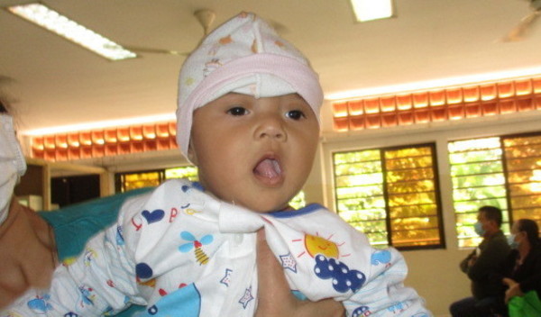 Success! Manich from Cambodia raised $229 to fund a cataract surgery ...