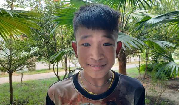 Success! Htun from Thailand raised $414 to fund a CT scan of his head ...