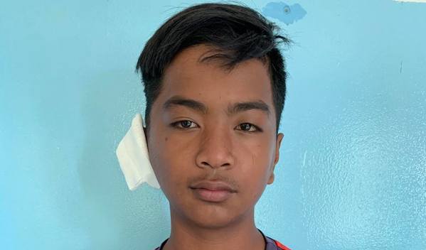 Success! Sok Leap from Cambodia raised $296 to fund ear surgery. | Watsi