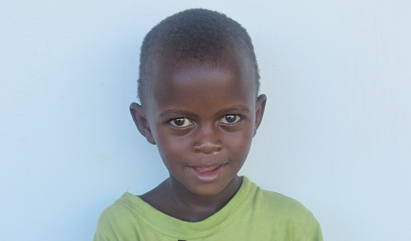 Success! Zakayo from Tanzania raised $874 to fund a burn contracture ...