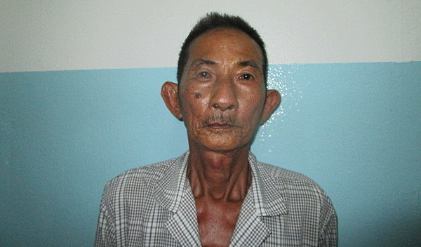 Success! Vuth from Cambodia raised $229 to fund cataract surgery. | Watsi
