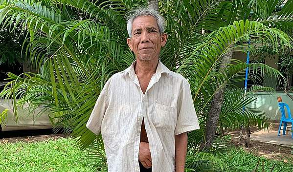 Success! Chorn from Cambodia raised $541 to fund burn treatment so he ...