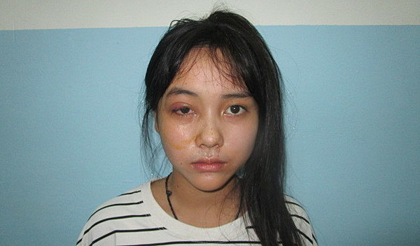 Success! Srey Neth from Cambodia raised $187 to fund surgery so she can ...