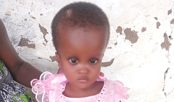 Success! Venesa from Kenya raised $720 to fund shunt insertion surgery ...