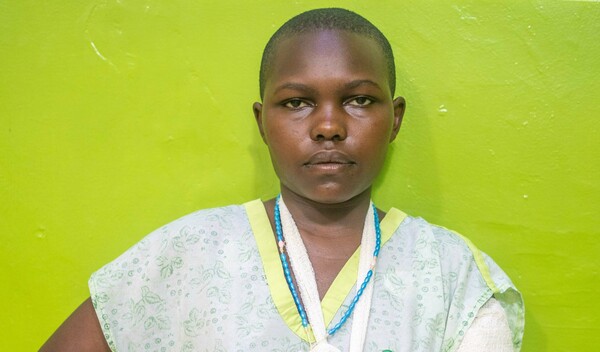 Success! Jackline from Kenya raised $840 to fund burn contracture ...