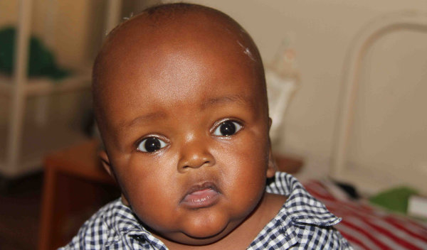 Clement from Kenya raised $980 to drain the excess fluid from his skull ...