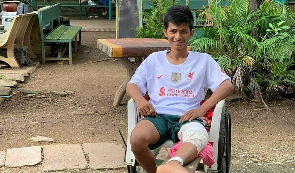 Success! Simeng from Cambodia raised $483 to fund a fracture repair ...