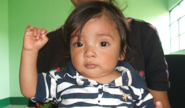 Esvin from Guatemala raised $525 so that he can resume normal ...