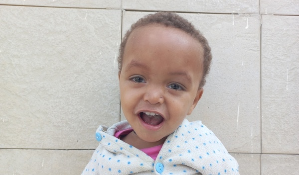 Success! Samuel from Ethiopia raised $1,293 to fund surgery for a birth ...