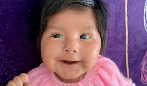 Success! Dayana from Bolivia raised $1,500 to fund life-saving heart ...