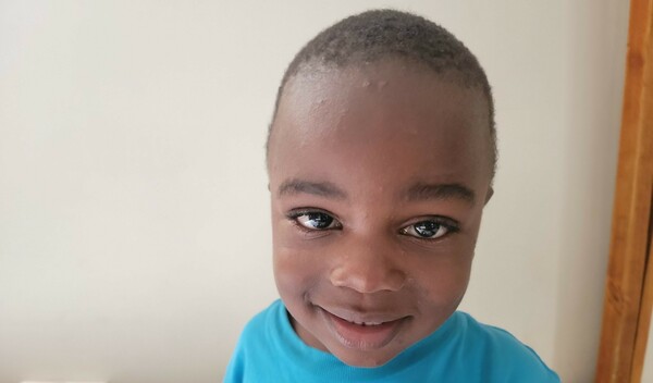 Success! Jayden from Tanzania raised $880 to fund corrective surgery ...