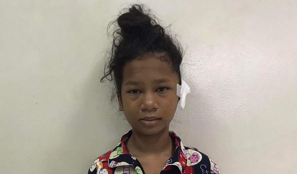 Success! Reaksa from Cambodia raised $851 to fund ear surgery. | Watsi