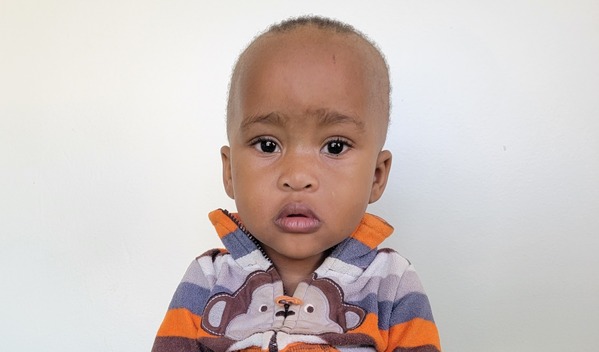 Success! Dinnah from Tanzania raised $341 to fund clubfoot treatment ...