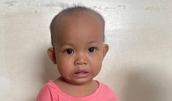 Success! Danin from Cambodia raised $173 to fund surgery to alleviate ...