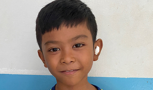 Success! Lihong from Cambodia raised $387 to fund surgery for his ear ...