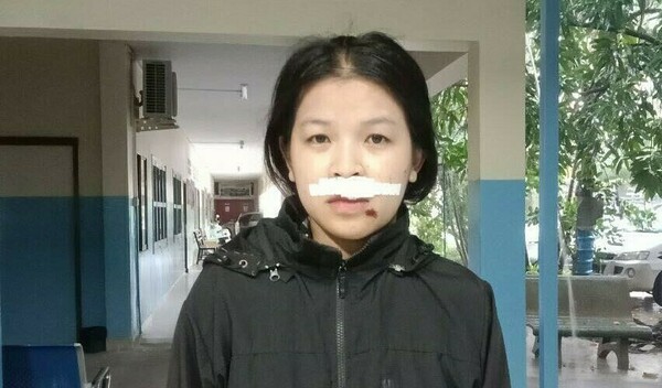 Success! Sok Horng from Cambodia raised $435 to fund fracture repair surgery on her finger. | Watsi