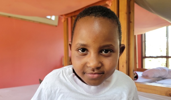 Success! Balbina from Tanzania raised $891 to fund corrective surgery ...