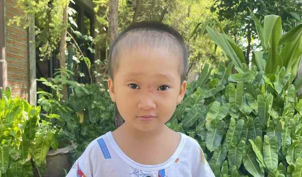 Success! Kyawt from Burma raised $693 to fund a CT scan. | Watsi