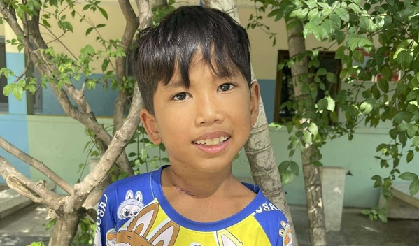 Success! Veasna from Cambodia raised $472 to fund corrective surgery ...
