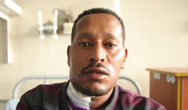 Success! Samuel from Kenya raised $1,115 to fund fracture repair ...